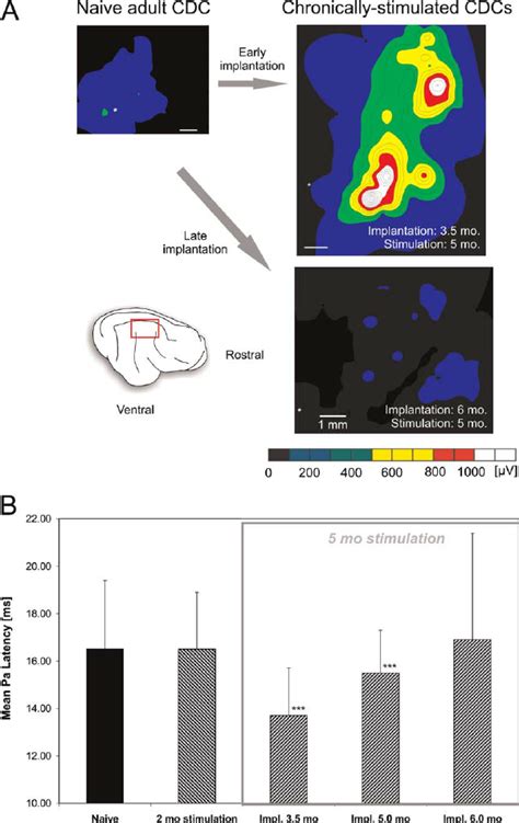 The Capacity For Plastic Reorganization With Cochlear Implant Download Scientific Diagram