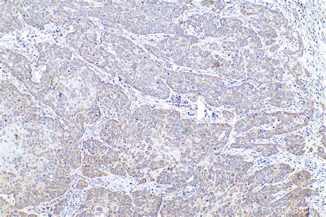 Ihceasy Mmp1 Ready To Use Ihc Kit Khc0804 Proteintech