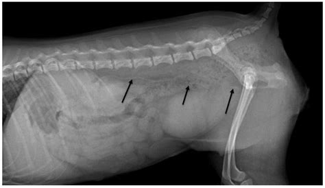 Lateral Radiograph Of Intravenous Pyelogram The Image Is Taken Early