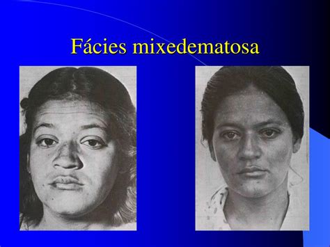 Ppt Exame Físico Geral Powerpoint Presentation Free Download Id474575