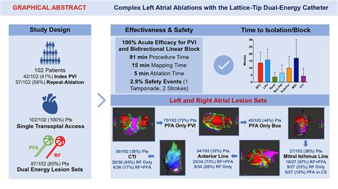 Pulmonary Vein Isolation And Beyond Feasibility And Acute Outcomes Of