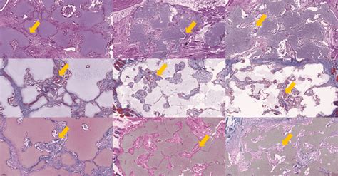 Histological Staining Shows The New Osteoid Bone Formation Yellow Download Scientific Diagram