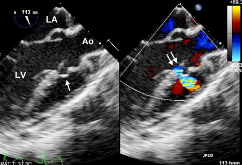 Vsd Virtual Section Dumper Just Another Virtual