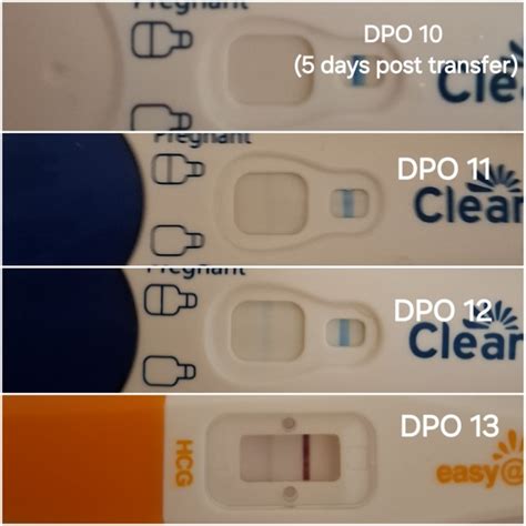 Pregnancy Test Line Progression Fet Cycle Mumsnet