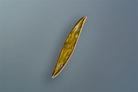 Euglena Under Microscope 40x