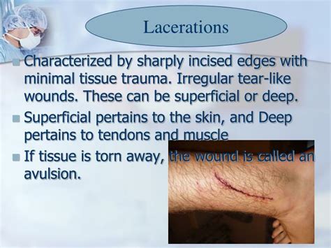 Laceration Wound Edges Description At Henry Briggs Blog