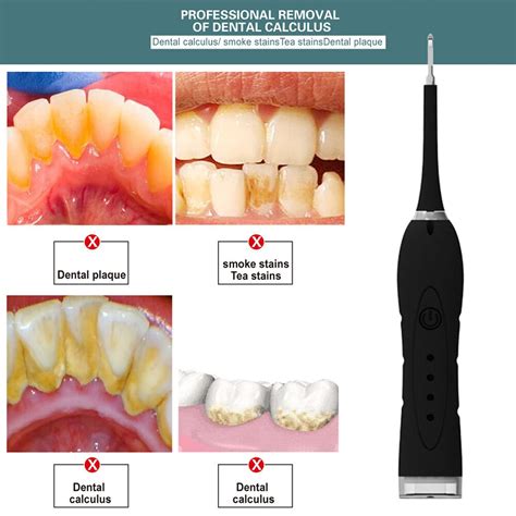 Portable Electric Dental Scaler Clean Tooth Travel Grandado
