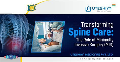 Transforming Spine Care The Role Of Minimally Invasive Surgery Mis