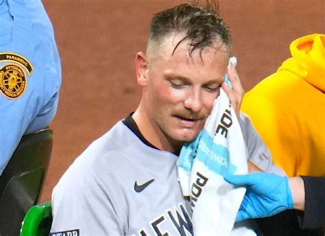 Latest On Yankees Anthony Misiewicz Who Had Teammates ‘sick To Stomach Taking Liner Off Head