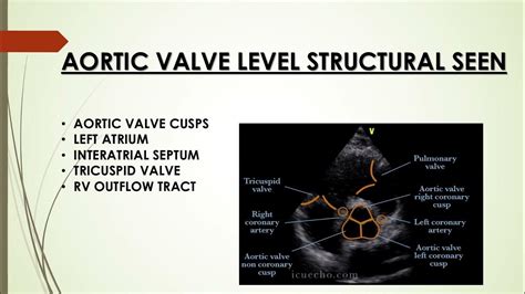 Transthoracic Echo Views Youtube