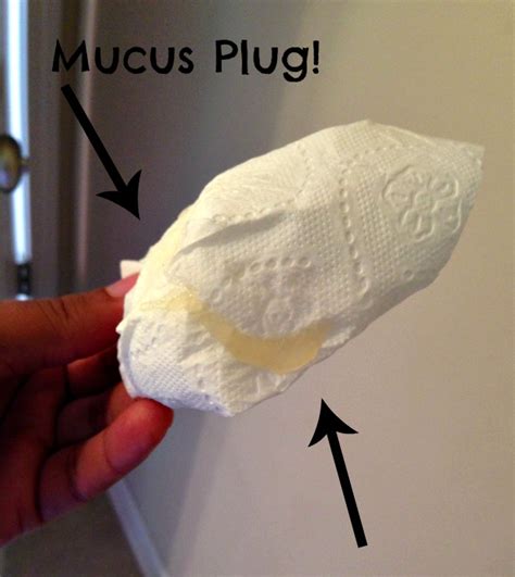 Yellow Mucus Discharge Third Trimester At Martha Cannon Blog