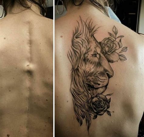 Creative Tattoos That Cover Scars 32 Pics