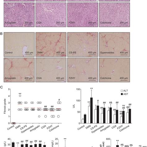 Hepatic Fibrosis Grading System Download Scientific Diagram