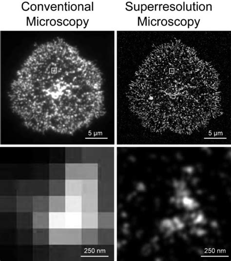 Single Molecule Microscopy To Analyze Protein Dynamics And