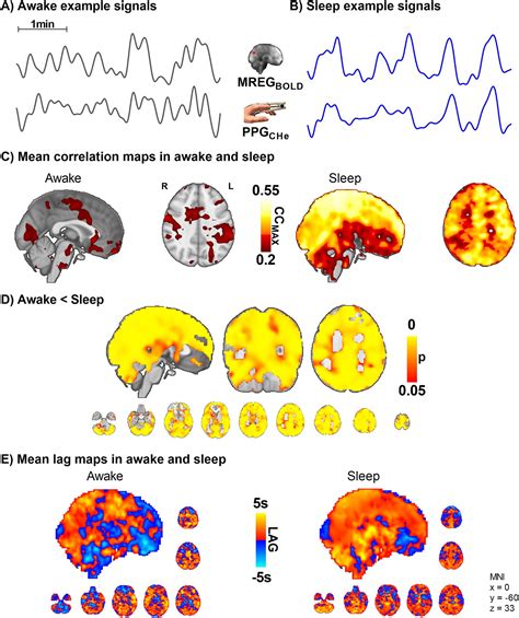 Frontiers | Cardiovascular and vasomotor pulsations in the brain and periphery during awake and ...
