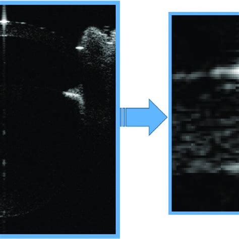 Blurred Boundaries With Low Contrast In A Chicks Cornea Although The Download Scientific