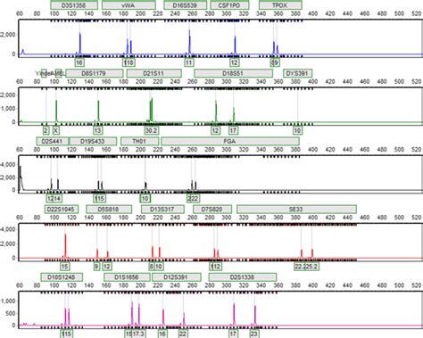 Electropherogram Of The Profile For Mixture 91 Replicate B This