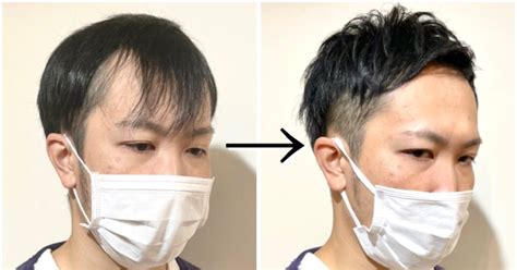 薄毛専門美容師が選ぶ M字ハゲに似合う髪型 薄毛に悩む男性の為の美容室ならRELIVE 薄毛に悩む男性のための完全個室美容室