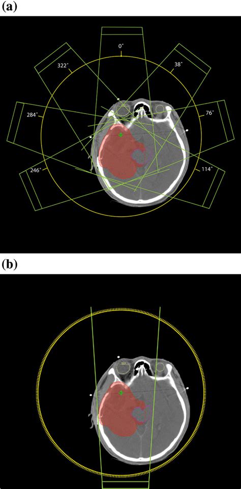 Varian Eclipse Semantic Scholar