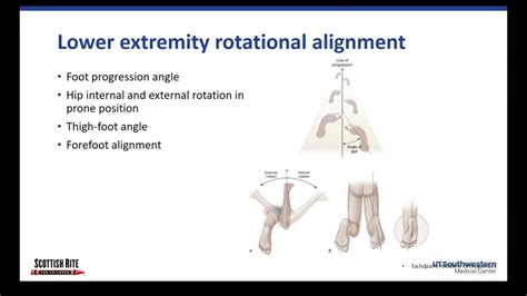 Lower Extremity Alignment Youtube