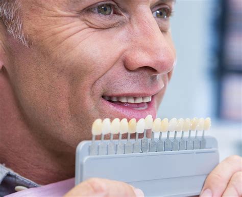 Correct Gummy Smiles And Small Teeth With Porcelain Veneers