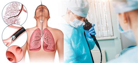 Bronchoscopy And Chest Medicine At Acme Hospital Chembur Navi Mumbai
