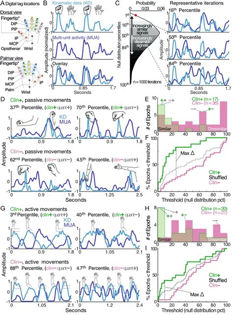 Determining Significance Of Neuro Motor Quantifications And Comparing