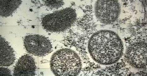 Who 엠폭스 공중보건 비상사태 10개월 만에 해제