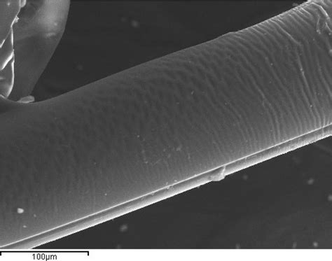 Haptic Part Of The Folded Modified Iol × 300 Download Scientific