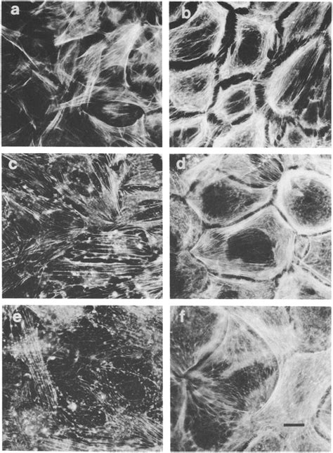 Figure L Fluorescent Staining Of Actin Containing Microfilament Bundles