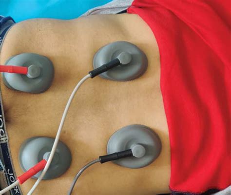 Non Operative Treatment For Low Back Pain A Review Of Evidence And