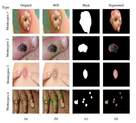 Threshold Based Segmentation A Original B Roi C Mask D