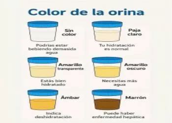 El Color De La Orina Puede Decir Mucho Sobre Tu Salud Y Estado De