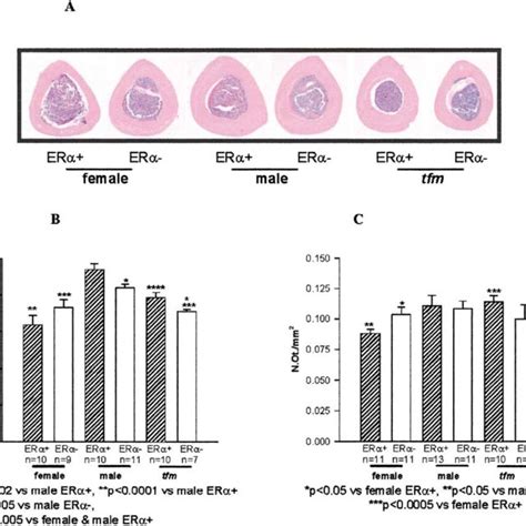 Bone Histomorphometry Of Proximal Tibia A Representative Sections Of Download Scientific