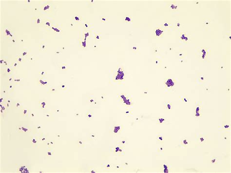 Staphylococci Gram Stain Gram Stains Update 2017 Ppt