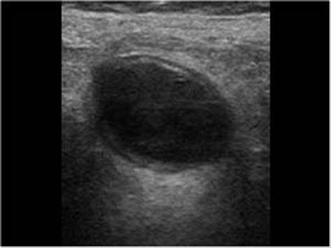 April 2009 Ultrasound Cases