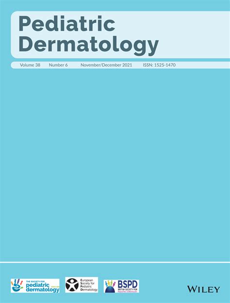 Severe Hypertriglyceridemia Following Sirolimus Use In An Infant