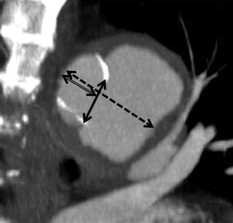 Presentation Complications And Natural History Of Penetrating