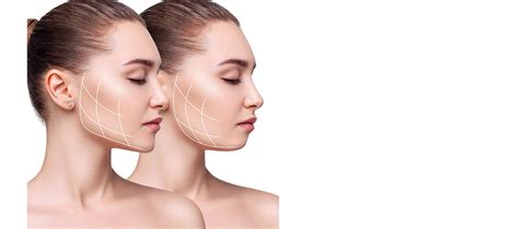 Jaw Prosthesis Opdroğuz Çörtük