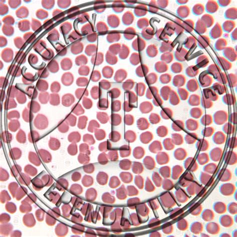 Blood Infectious Mononucleosis Lymphocyte Variation Smear Southern