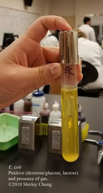 Microbiology Carbohydrate Fermentation Basic Sciences