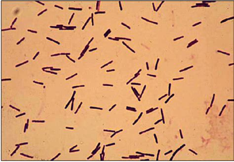 Clostridium Gram Stain