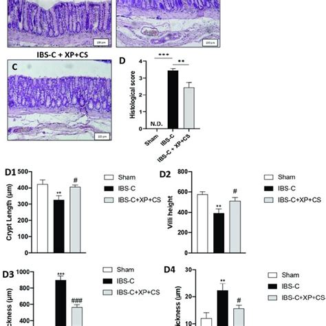 Xp And Cs Treatment Alleviate Ibs Constipation Histological Evaluation