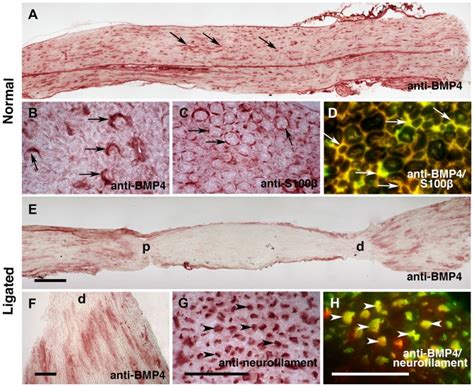 Ad Normal Sciatic Nerves Were Cut Into Longitudinal A Or Cross