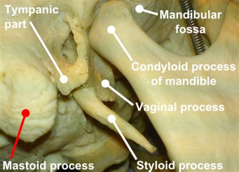 Mastoid Bone Behind The Ear Anatomy Function Complications And Facts
