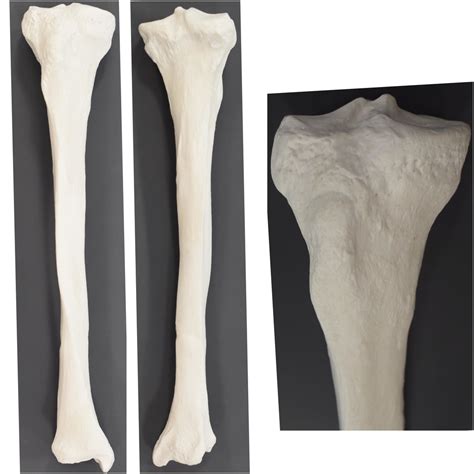 Identify The Parts Of The Tibia Diagram Quizlet