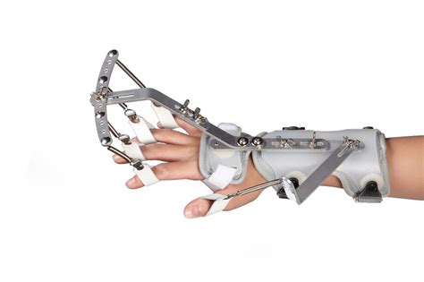 Dynamic Orthosis At Roderick Tipton Blog