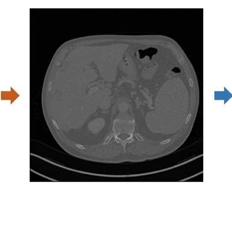 Preprocessing Procedures Download Scientific Diagram