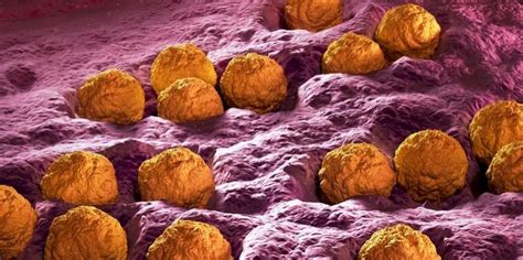 风疹 Nfid 疫苗网