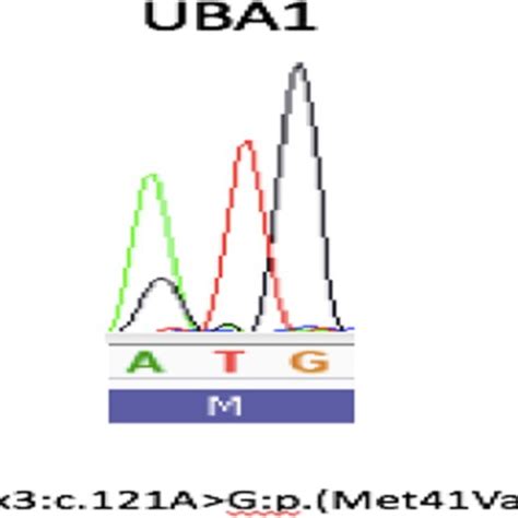 Genotype Sequencing Of The Patient Uba1 Mutation Pmet41val